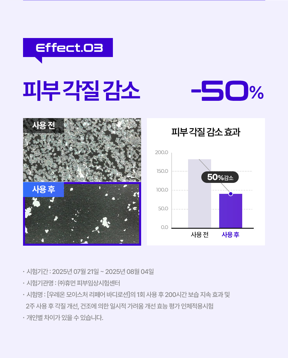 우레온 모이스춰 리페어 바디로션 문제성피부 닭살피부 뱀살 - 중앙일보 핫딜 | KoreaDaily Hot Deal
